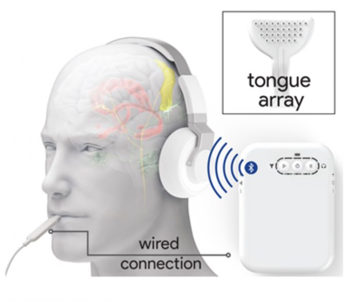 Acufene, la stimolazione cerebrale doppia funziona - Galileo